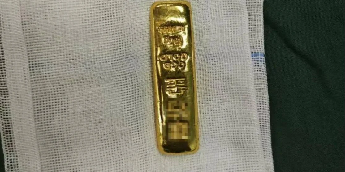 11-річний хлопчик проковтнув золотий злиток / NV