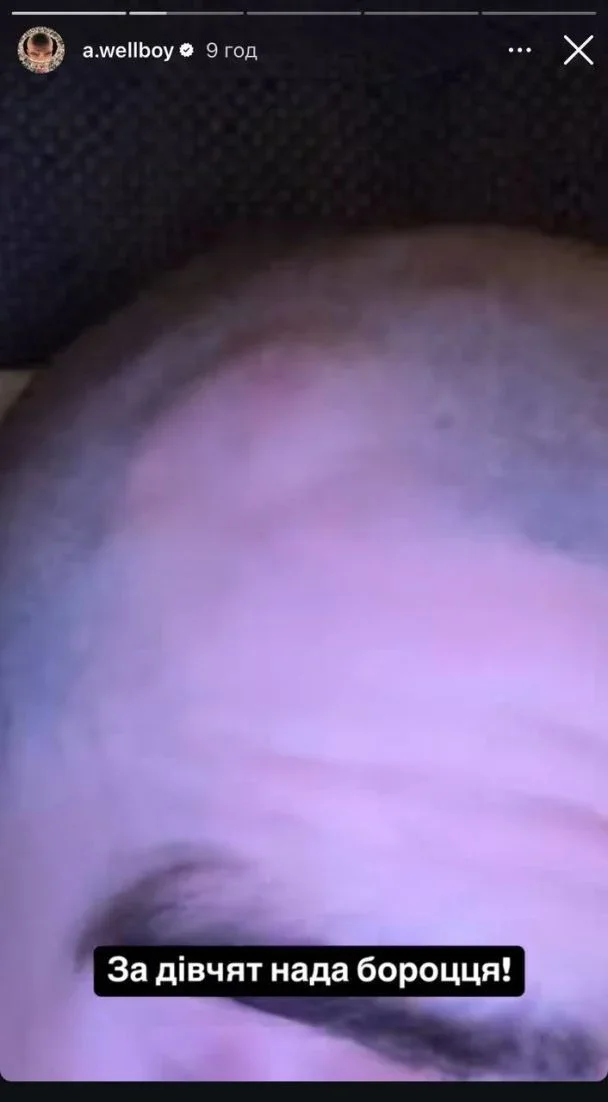 Невідомі напали на Wellboy — наслідки бійки — Фото / NV