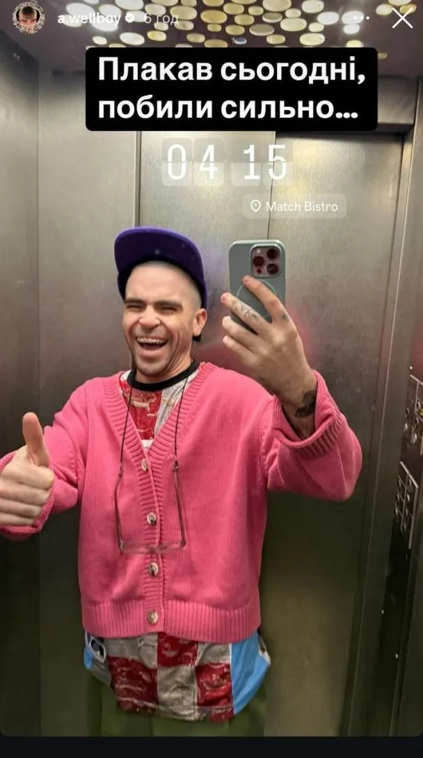 Неизвестные напали на Wellboy — последствия драки — Фото / NV